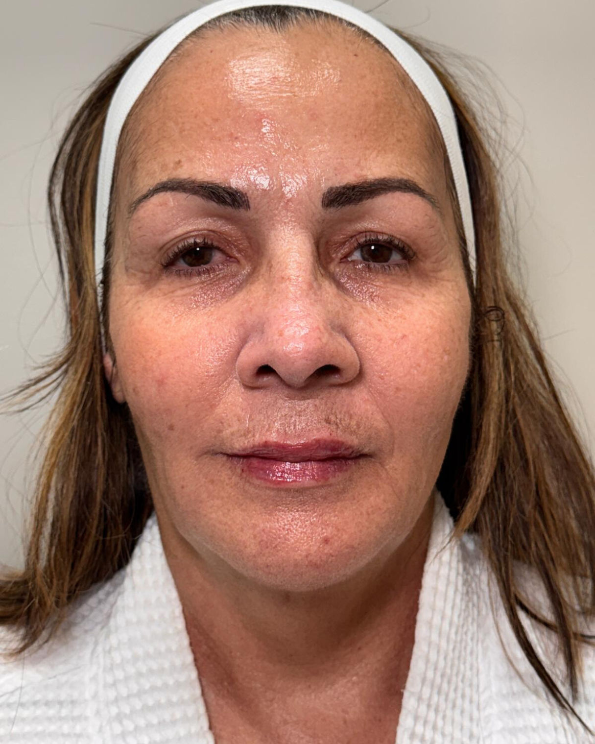 Daidi Cruz MSN APRN - Aesthetic Nurse Practitioner in Miami