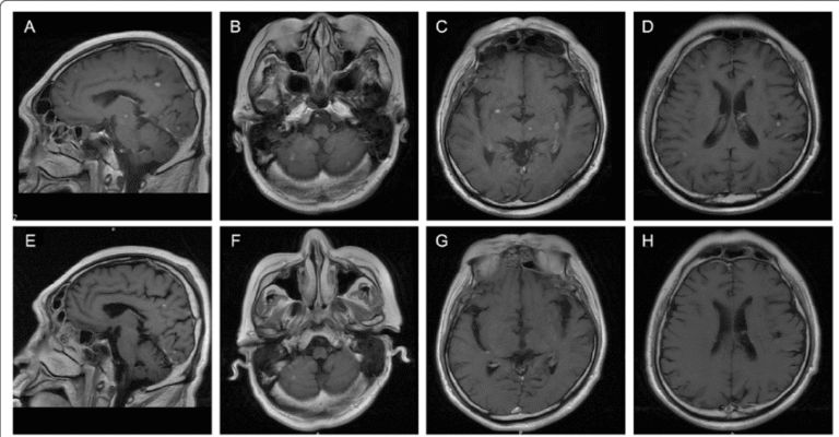 Gadolinium Uses: Why Scientists Rely on This Rare Earth for Medicine ...