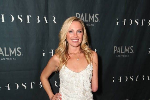 The Bachelor’s Sarah Herron Born With One Arm