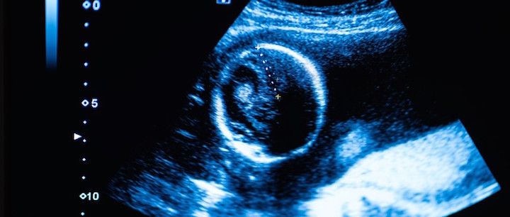 When Is the Earliest an Ultrasound Can Diagnosis Pregnancy?