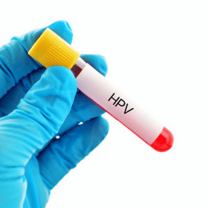 HPV Test Kit, HPV Type Variant testing for Home