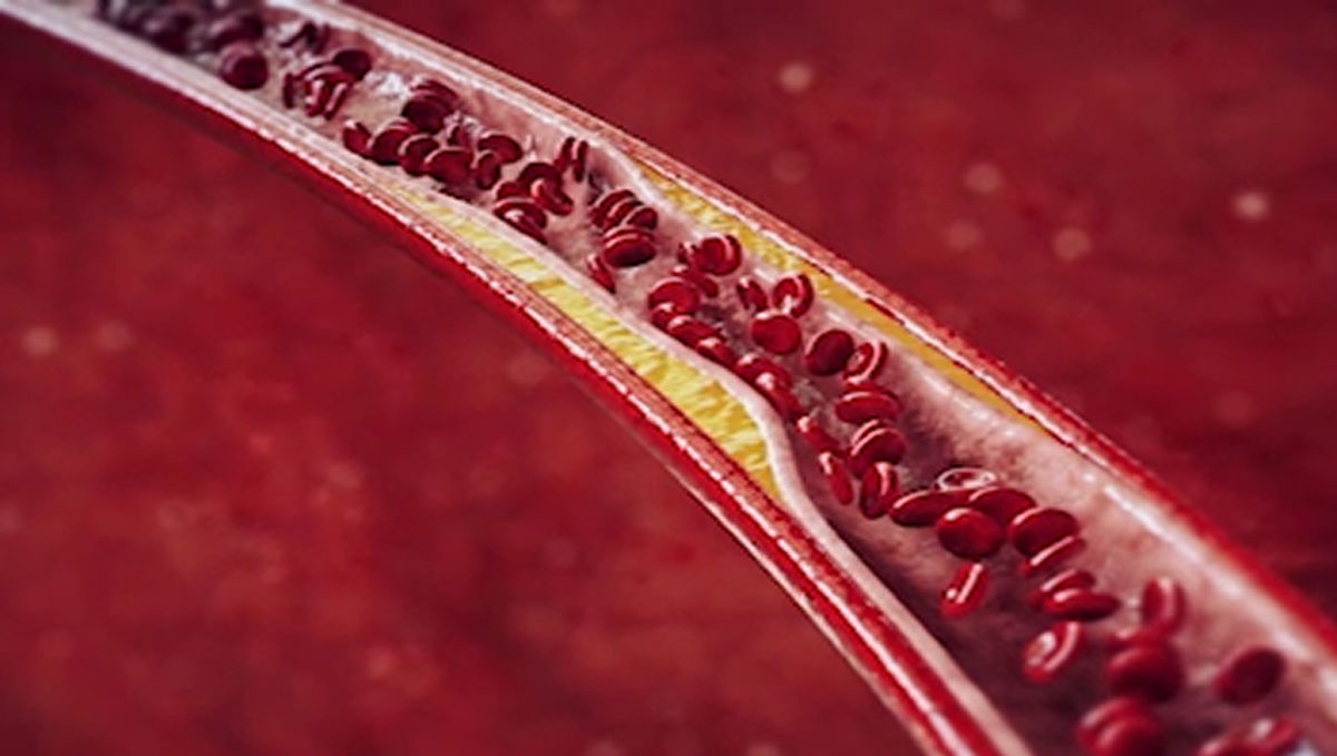 Buy The Phoenix - Acoustic Wave Therapy Device