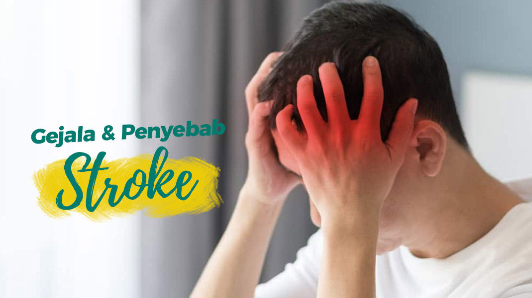 Penyakit Stroke: Gejala, Penyebab, Jenis Hingga Cara Mencegahnya ...