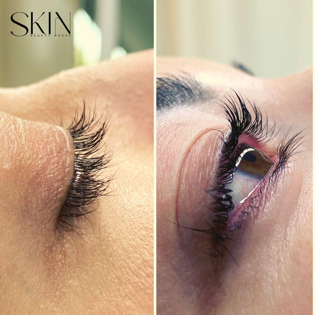 Laminácia mihalníc | SKIN Beauty house | Komárno