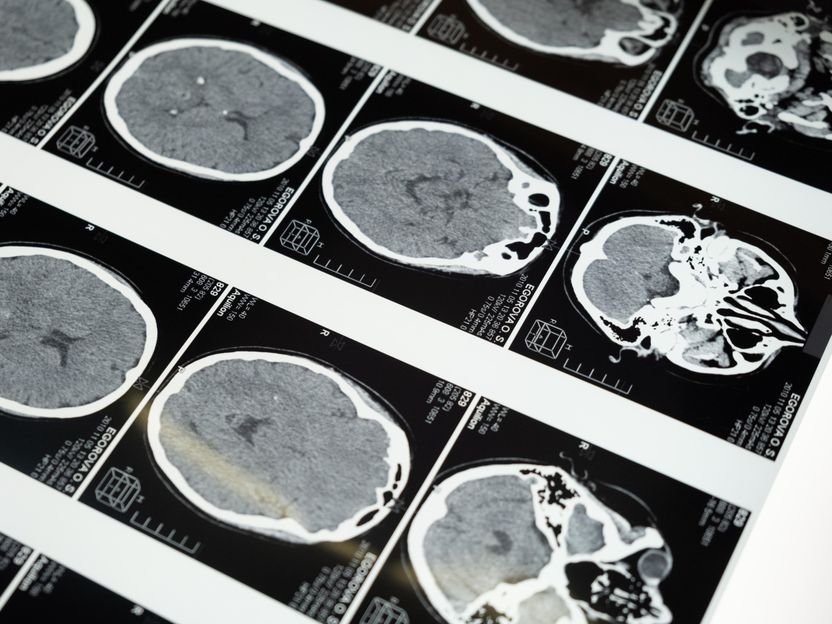 New model of cerebral cortex development identified