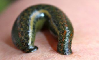 How To Remove A Leech (And Treat The Bite)