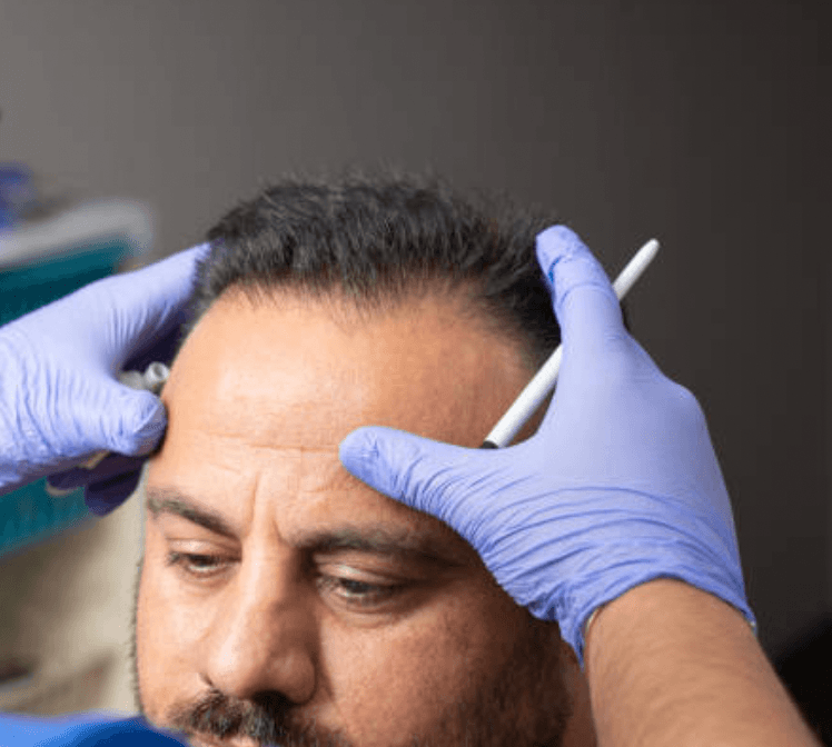 Men’s Hair Loss Explained - Stages, Solutions, and When to Act | Blog ...