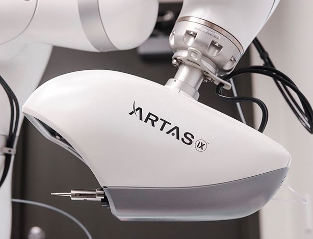 ARTAS iX – A Robotic Hair Transplant System | Blog | Tir na nÓg Clinic
