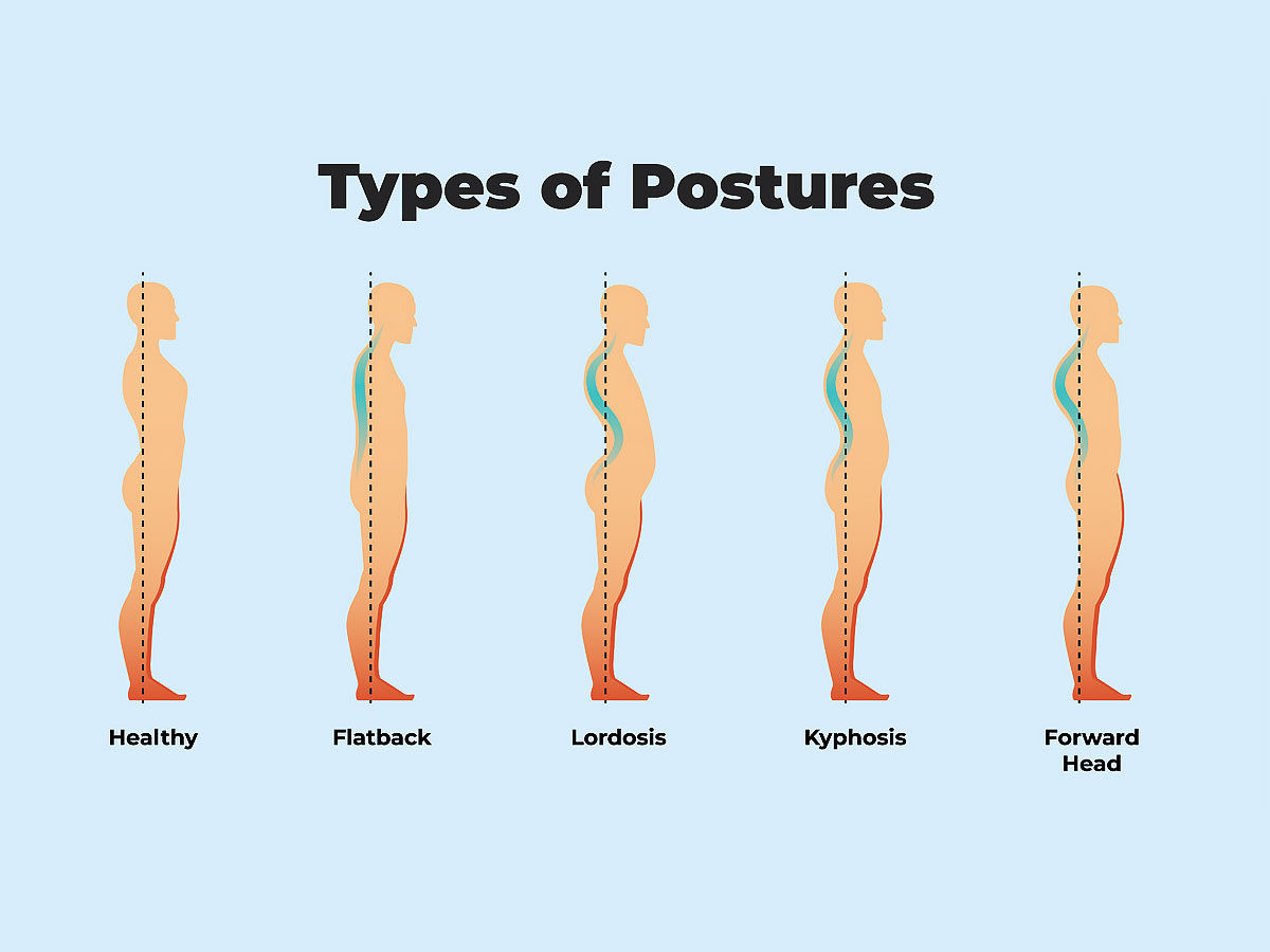 7 Exercises to Improve Your Back Posture