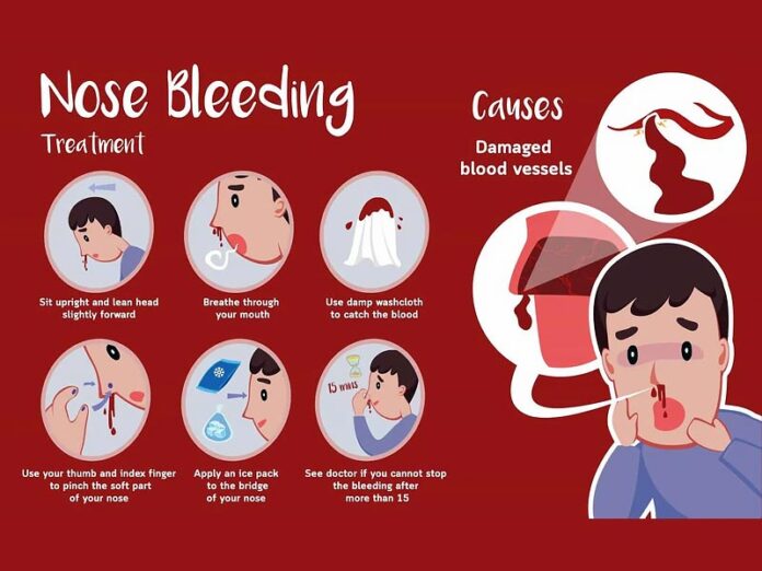 Nose Bleeding: Causes and Diagnosis