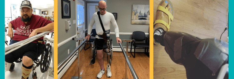 Finding Financial Assistance for Amputees