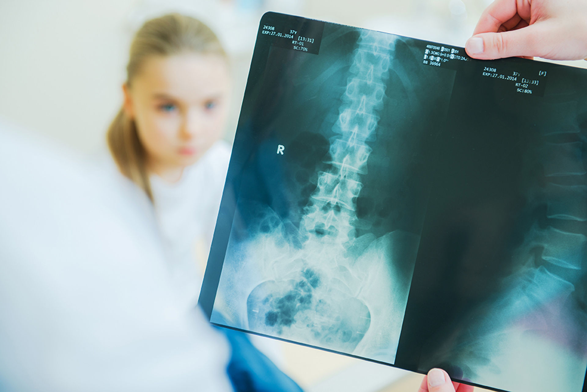 Imaging and Kids: FDA Recommends Lowest Radiation Exposure for X-Rays ...