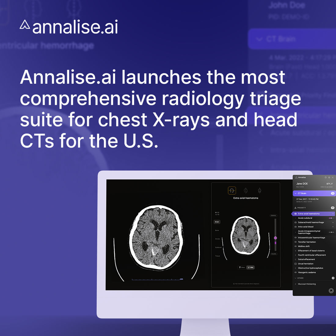 Annalise.ai launches the most comprehensive radiology triage suite for ...
