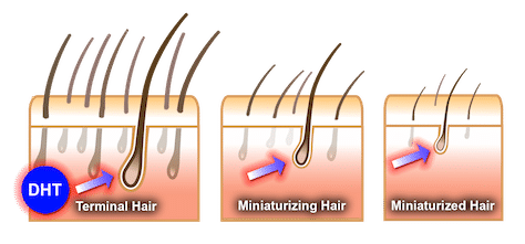 Hair Loss, Hair Growth Cycle | Medispa Hair Transplant India